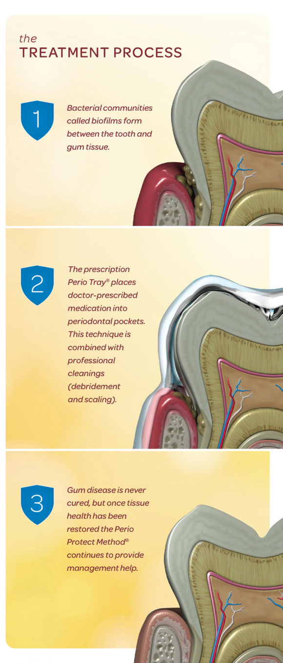 Barbara Mallonee DDS | Perio Protect